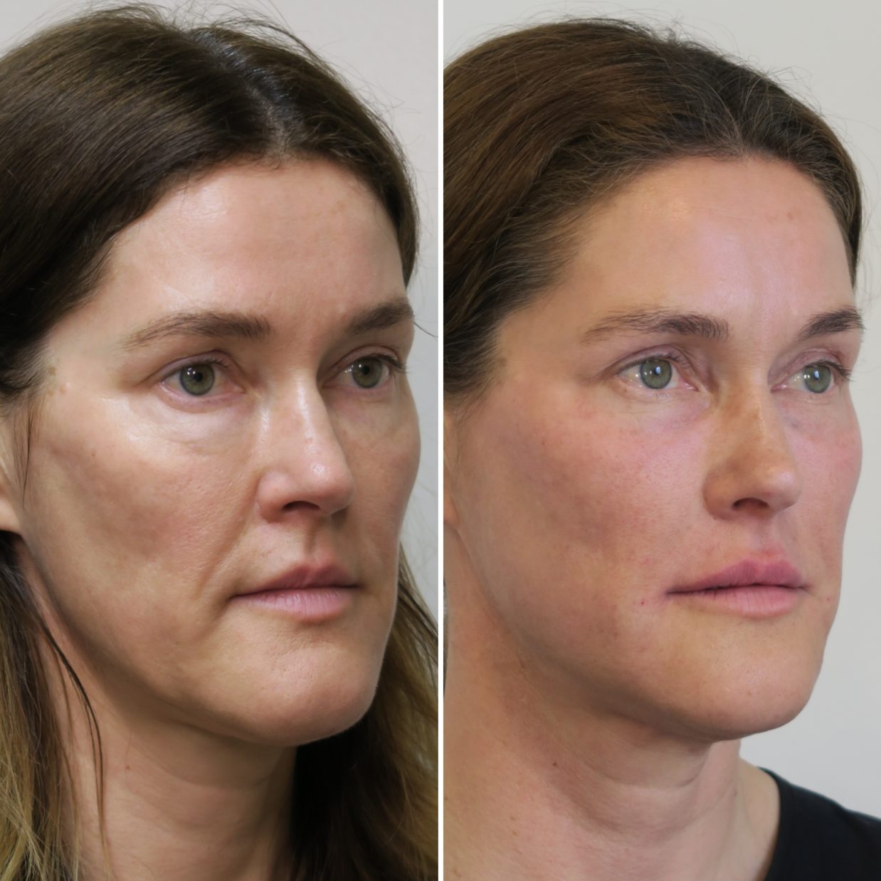 Dr Joshua's non-surgical treatments for 2021 | UPTOWN STYLE Media